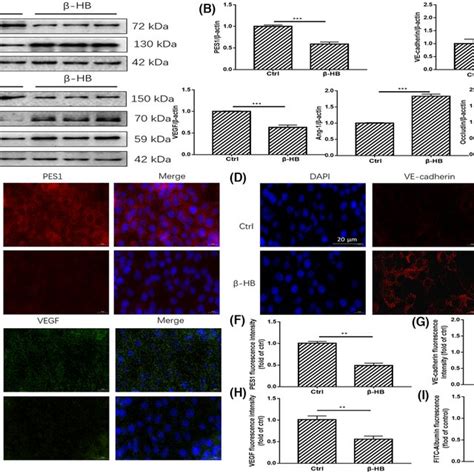 β‐hb Treatment Reduced Vascular Endothelial Paracellular Permeability
