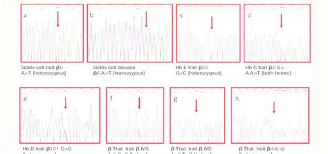 Capillary Electropherogram Results Of Dna Sequencing By Pcr Amplified
