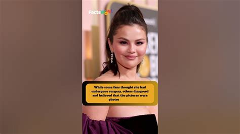 Selena Gomez's Transformation: Unveiling The 'fox Eye' Surgery Speculations - YouTube