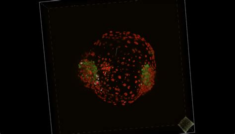 First Synthetic Human Twin Embryo Brightlands