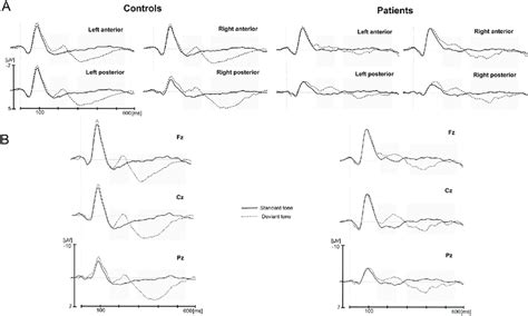 Oddball Auditory Task A Grand Average Erps At Standard Solid Line