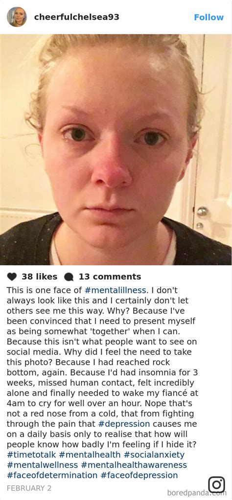 Xanthopsia Symptoms Ppt Heart Failure 3 Of 3 Treatment Powerpoint