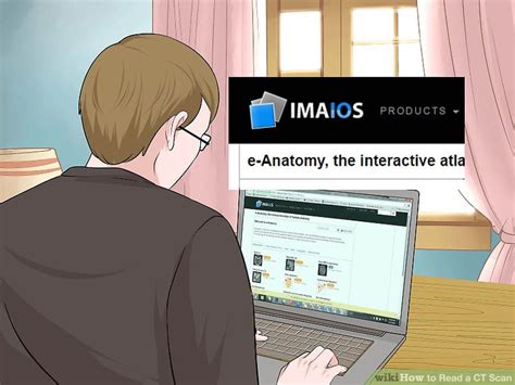 How To Read A CT Scan Steps With Pictures WikiHow