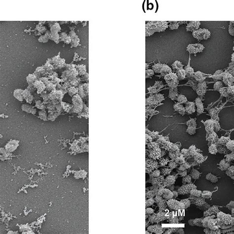 A Combination Aldehyde Fixative Solution Is Superior To Glutaraldehyde Download Scientific