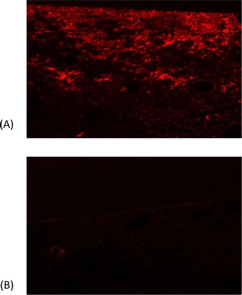 Recharge And Increase In Hardness Of Gic With Cpp Acp F Pocket Dentistry