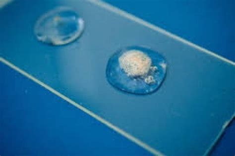 Catalase Test Principle Procedure And Result Interpretation