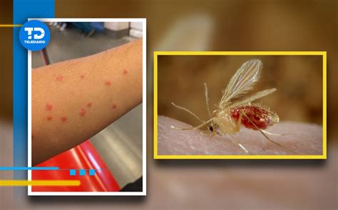 Jejenes Qué Tan Peligrosos Son Los Mosquitos Que Hay En Nuevo León