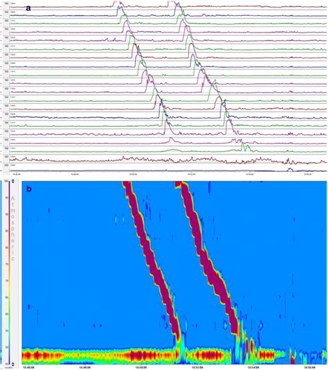 Example Of Conventional A And Spatiotemporal Plot B In A Subject Download Scientific