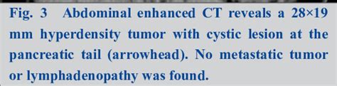Abdominal Enhanced Ct Reveals A 28×19 Mm Hyperdensity Tumor With Cystic Download Scientific
