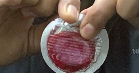 Case Report Intimate Partner Sexual Assault ACEP Now