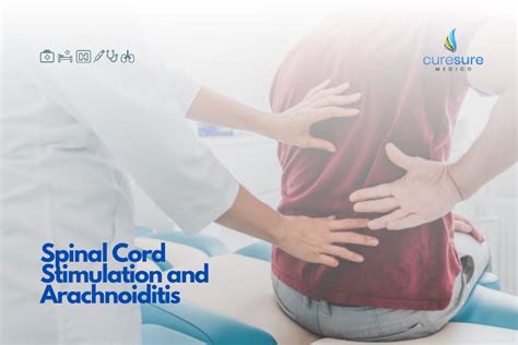 Spinal Cord Stimulation And Arachnoiditis