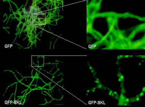 peroxisomal localisation of egfp skl fluorescence microscopy was