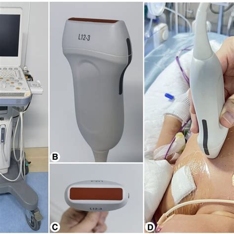 A Philips Cx50 Portable Color Ultrasound Bc Linear Array Shallow Download Scientific