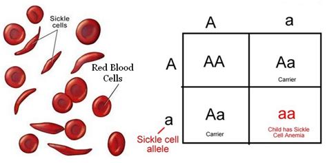 Sickle Cell Anemia PowerPoint Copy1 At Emaze Presentation