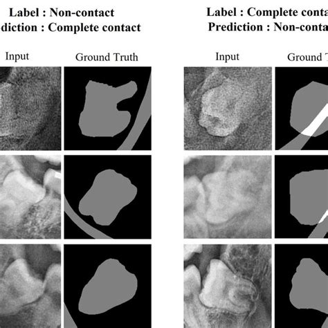 Visualization Of Relationship Misclassification Results By Download Scientific Diagram