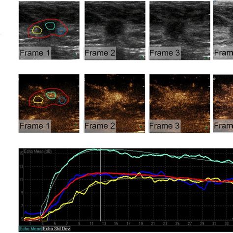 Illustration Of Different Denoising Methods On Breast Ultrasound The Download Scientific