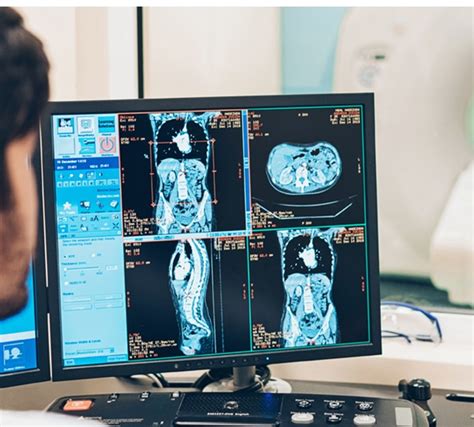 Improving Breast Cancer Detection With A Quantum Neural Network