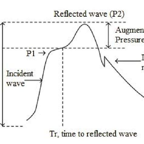Aortic Pressure Waveform Download Scientific Diagram
