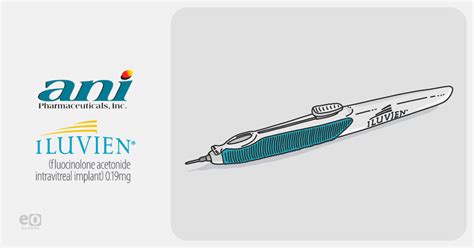 Fda Approves Expanded Label Of Iluvien For Chronic Posterior Uveitis