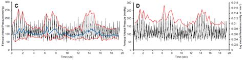 A First Using Thermodilution To Measure Cardiac Output In A Running Human Human Performance