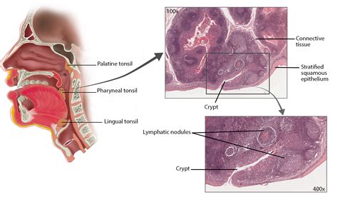 Lingual Tonsil Histology Lingual Tonsil Anatomy And Histology