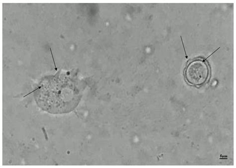 Experimental Granulomatous Amebic Encephalitis Caused By Acanthamoeba