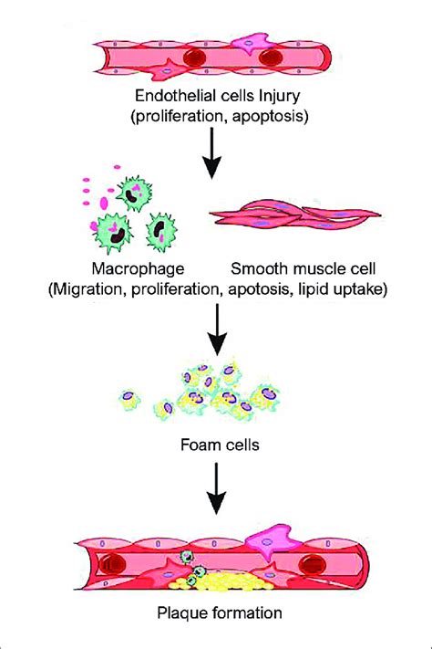 The Pathogenesis Of Atherosclerosis Download Scientific Diagram