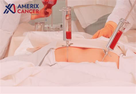 Bone Marrow Transplant