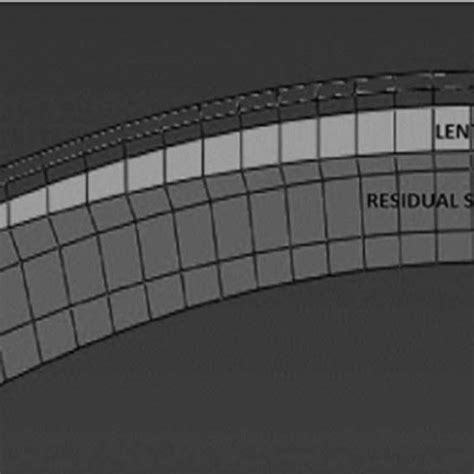 A Representative Side View Of Cornea Scleral Finite Element Mesh B
