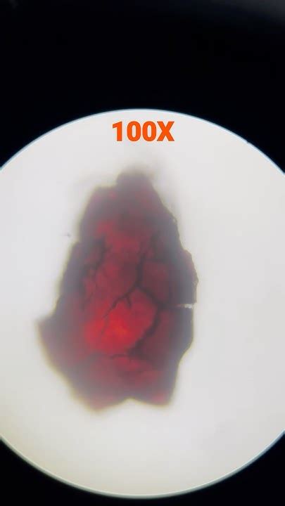 Scab Under The Microscope Microscopicworld Science Microscopy