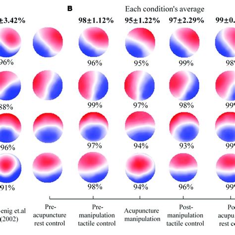 The Spatial Correlation Percent And Electroencephalography Eeg Download Scientific Diagram