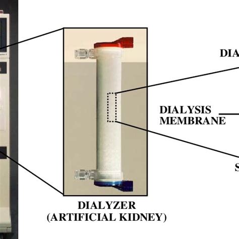 Schematic Representation Of Diffusion Between Blood And Dialysate