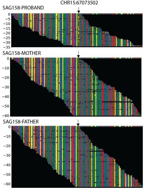 Figures And Data In Two Locus Inheritance Of Non Syndromic Midline Craniosynostosis Via Rare