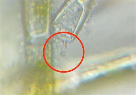 Found A Bunch Of Stuff In Filamentous Algae R Microscopy