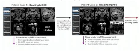 Eau 2023 Artificial Intelligence And Radiologists At Prostate Cancer Detection On Mri