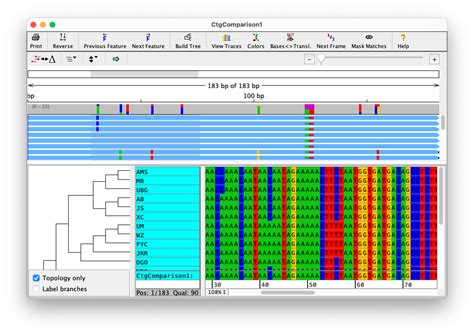 Sequence Alignment Software Codoncode Aligner For Dna Analysis