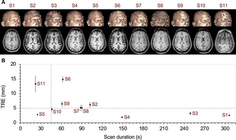 Development Of An Ultrafast Brain Mr Neuronavigation Protocol For