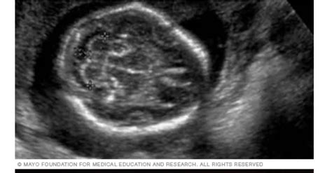 Solved Each Ultrasound Image Has A Part Of The Fetal