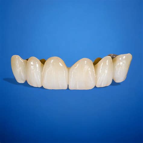 Multi Layer Zirconia Crowns Layered Cad Cam Fabrication