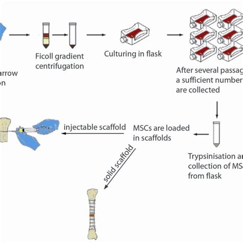 Concept Of Cell Based Tissue Engineering Autologous Stem Cells Are