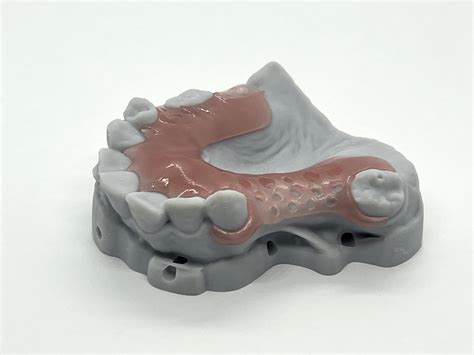 Flexible Partial Frame With Model Gps Digital Rpd