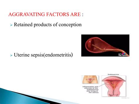 Subinvolution Of The Uterus Pptx