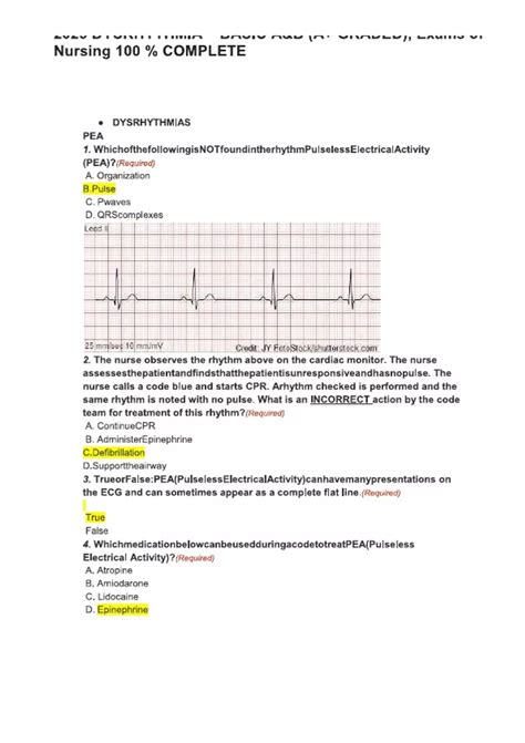 Relias Dysrhythmia Basic Testbank Answers Dysrhythmia Basic Aandb Nursing Stuvia Us