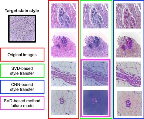 Neural Stain Normalization And Unsupervised Classification Of Cell Nuclei In Histopathological