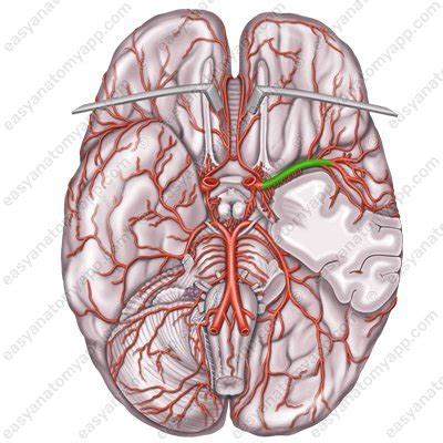 Internal Carotid Artery Easy Anatomy 3d
