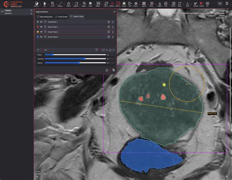 Dicom Metadata Extraction A Comprehensive Guide For Medical Imaging