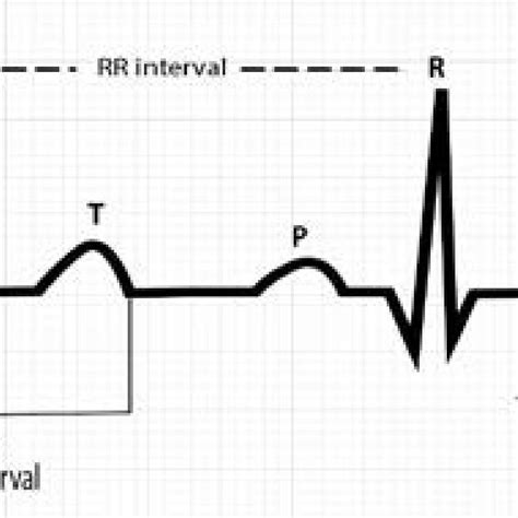 Demonstration Of Rr Qt And Tp E Intervals In Electrocardiogram