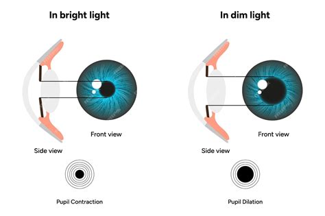 Premium Vector Pupil Size In Different Lighting Dilated Pupil And Undilated Pupil With Eye