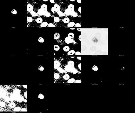 Matlab Red Blood Cell Color Image Segmentation Signal Processing