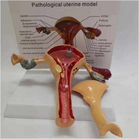 Buy Uterus Model Anatomopathological Model Of Uterus Anatomical